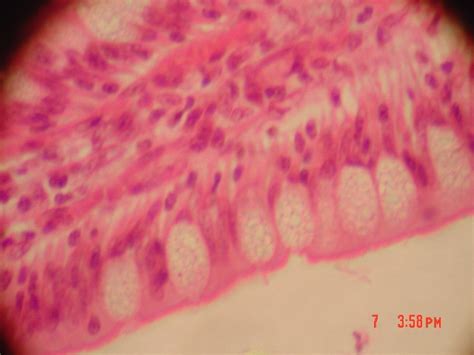 Compound Epithelial Tissues Superficial Cervical Squamous Epithelial