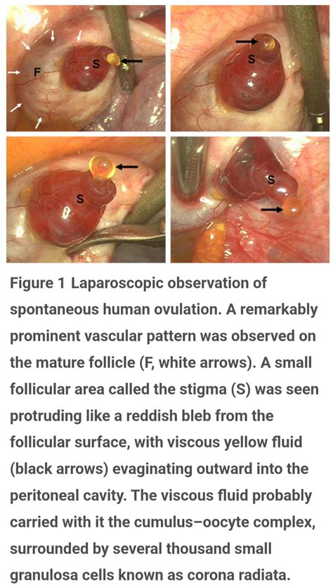 Ovulation Photos Source In Comments Rbadwomensanatomy