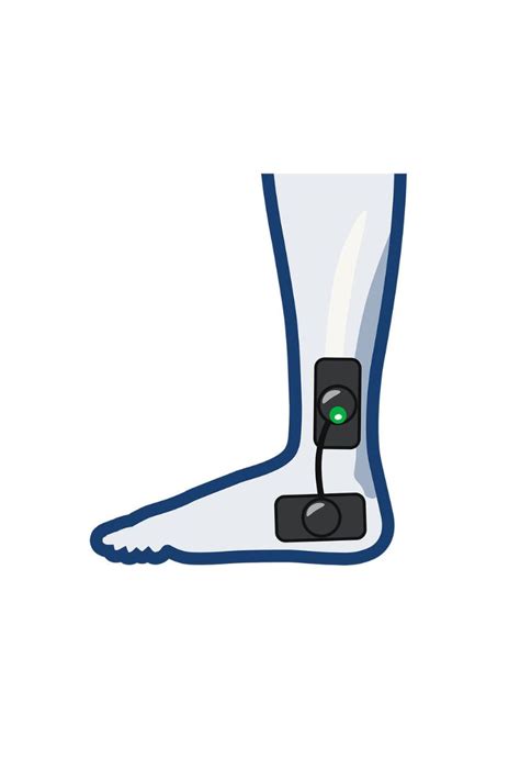 Colocación De Electrodos Para Electroestimuladores Musculares Ems