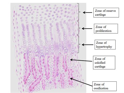Schematic Diagram Of Endochondral Ossification