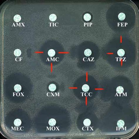 Site De Microbiologie Medicale