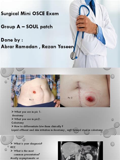 Mini Osce Surgery Group A Soul 2014 Download Free Pdf Colonoscopy