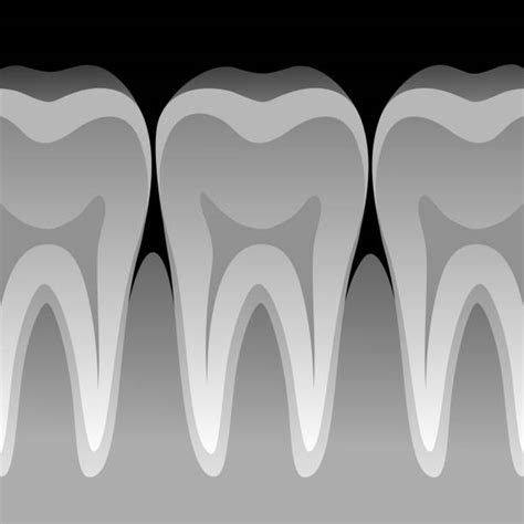 160 Dental X Ray Illustrations Stock Illustrations Royalty Free