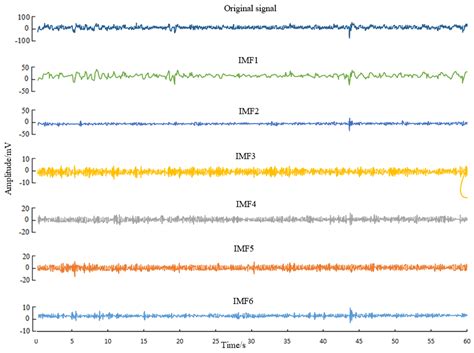 Epileptic Eeg Signal Detection Using Variational Modal Decomposition And Improved Grey Wolf