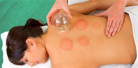 What Is Cupping And What Are The Benefits 12 Products To Use At Home Yourtango