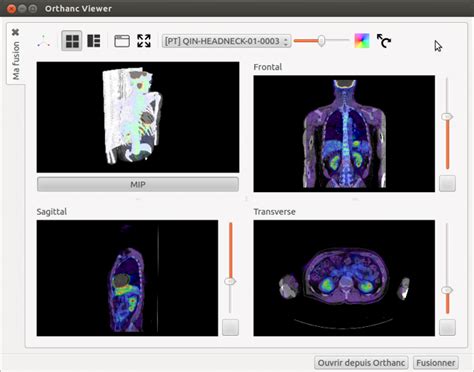 Orthanc Dicom Server