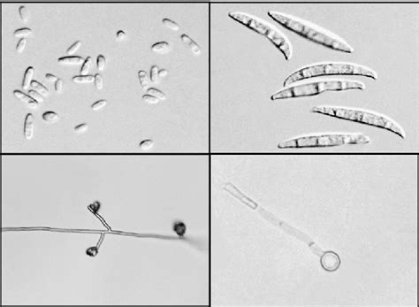 Microconidia Of Fusarium