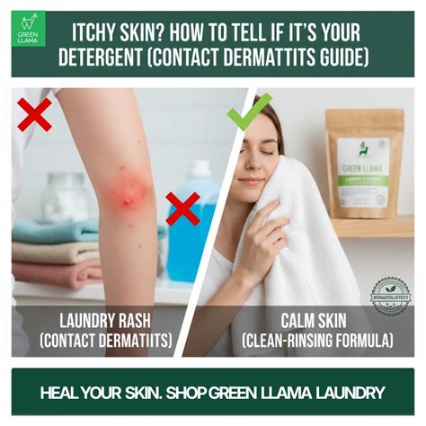 Itchy Skin How To Tell If Its Your Detergent Contact Dermatitis