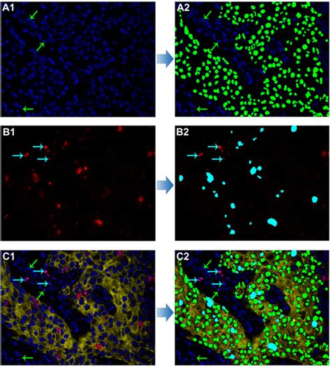 The Technical Procedures Of Ki67 Counting By Computerized Method Download Scientific Diagram