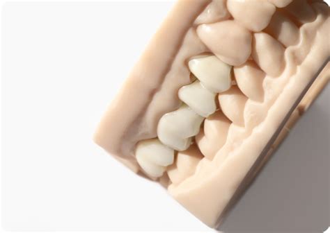 D2740 Dental Code Porcelain And Ceramic Crowns Dandy