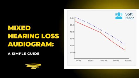 Mixed Hearing Loss Audiogram A Simple Guide Soft Hear Blogs