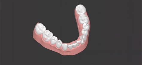 Sasa Martinovic On Linkedin Next Please ☝ Pure Aligneurs