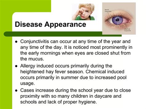 Conjunctivitis Final Presentation Pptx