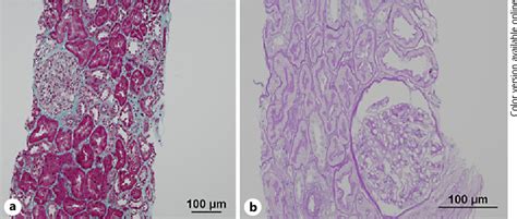 Figure 1 From Use Of Mixed Lymphocyte Reaction Assay To Evaluate Immune