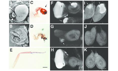 Eya Gene Function Is Essential For Ectopic Eye Formation By The Eyeless Download Scientific