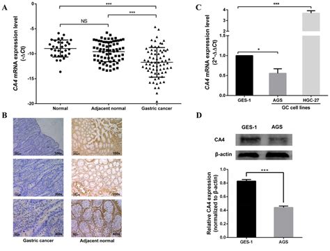 Downregulation Of Ca4 Expression In Gc Tissues And Cell Lines A The Download Scientific