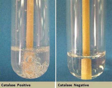 The Science Behind Catalase Lab Results Unlocking The Mystery Of