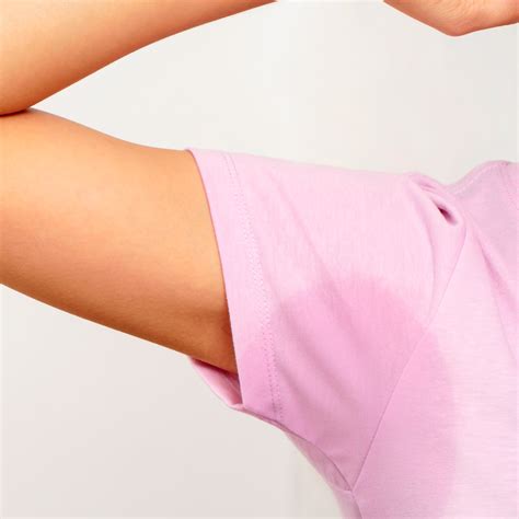 Sudoración Excesiva Hiperhidrosis Stetik · Centro Médico Estético