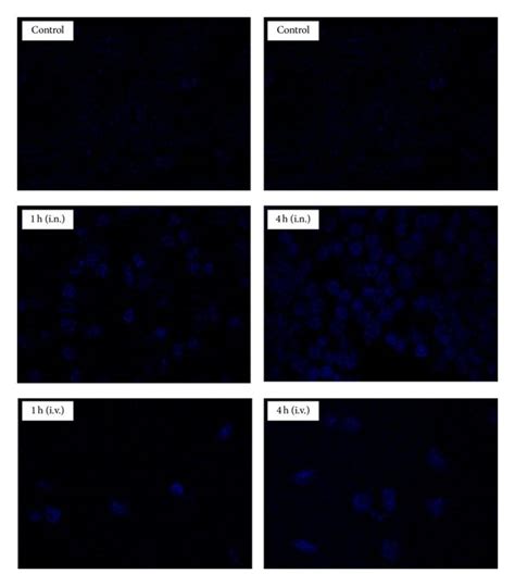 Qualitative Localization Of Dapi Loaded Plga Nanoparticles In Brain Qualitative Localization Of Dapi Loaded Plga Nanoparticles In Brain