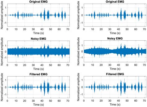 A Smart Approach To Emg Envelope Extraction And Powerful Denoising For Humanmachine Interfaces