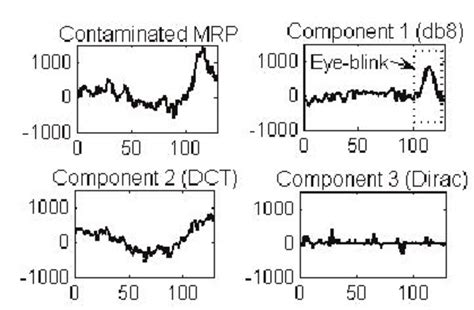 decomposition of the single trial mrp contaminated by eye blink