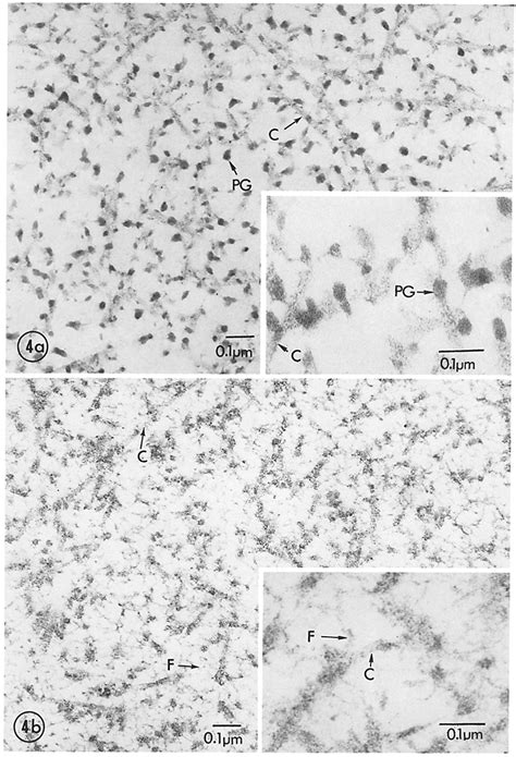 Electron Micrograph Of The Extracellular Matrix From The Download Scientific Diagram