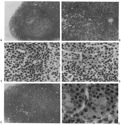 Cervical Lymph Nodes Of Scid Ig Mouse Showing Multifocal Sites Of Download Scientific Diagram