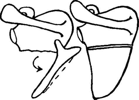 Unusual Presentation Of Fracture Scapula Pmc