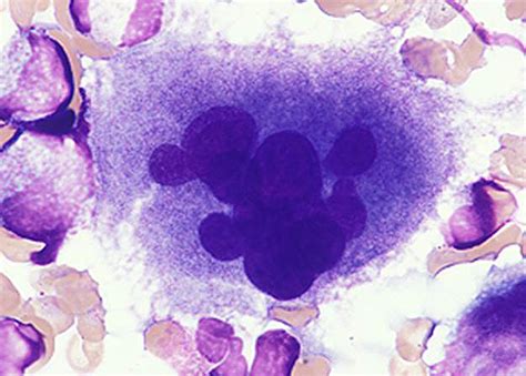 血液腫瘍画像データベース