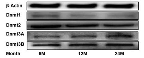 Dnmt3b Antibody Affinity Biosciences