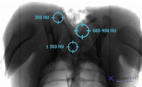Chicken Bone Detection Facts On Detection Capabilities For X Ray