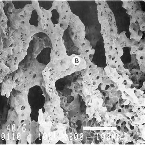 Surface Micrograph Of A Fetal Otic Capsule Sample A Surface Of The