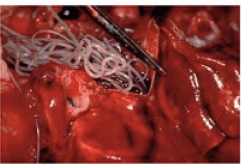 Bio 1204 Protostomes Ii Ecdysozoa Flashcards Quizlet