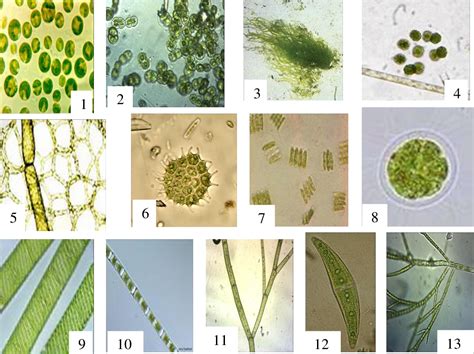 Figure 1 13 From Phenological Diversity Of Chlorophycean Algae From River Ganges At Varanasi