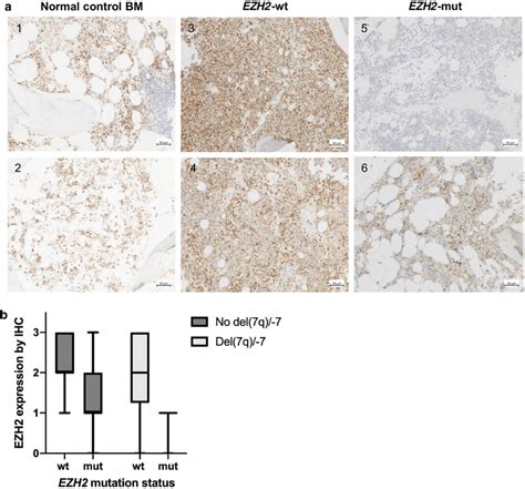 Ezh2 Mutations Result In Decreased Ezh2 Protein Expression A Download Scientific Diagram