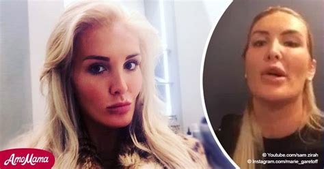 Marie Garet Secret Story 5 Défigurée Dans Un Accident Jaurais