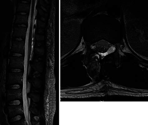 Three Dimensional Phase Contrast Magnetic Resonance Imaging For The