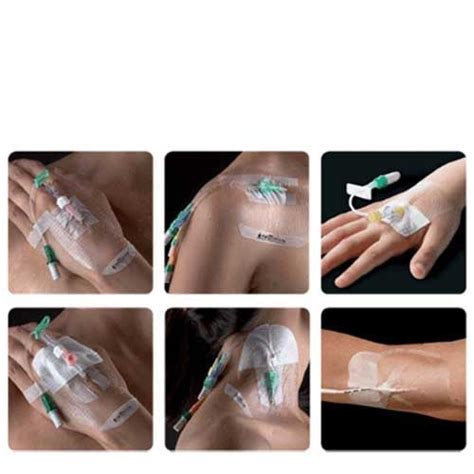 Iv3000 Moisture Responsive Catheter Dressings Peripheral Central