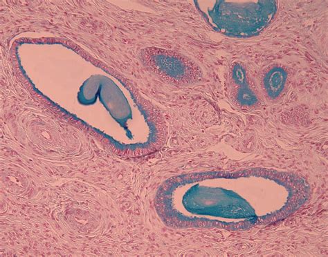 Cervix 1 Saffron Scientific Histology Services