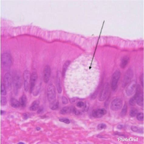 O Que São Células Caliciformes Retoedu