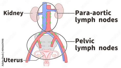 The Pelvic And Para Aortic Lymph Nodes Labeled Diagram Png Stock Illustration Adobe Stock