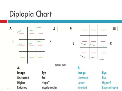 Diplopia Chart And Its Uses Pptx