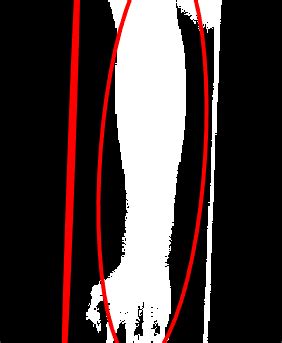 Python Rotate Incomplete Box So It Is Vertical Stack Overflow