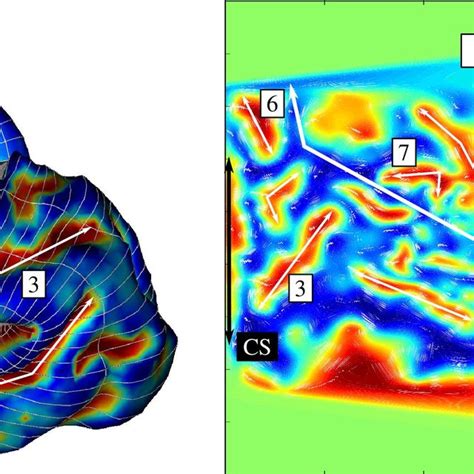 Left Surface Based Referential Defined On The Developing Cortical