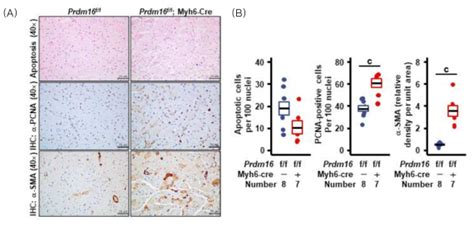 [보고서]tgf β 신호 전달 제어를 통한 Prdm16의 심장 기능 조절 기전 연구