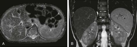 The Spleen Radiology Key