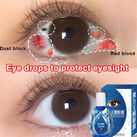 100 Effective Eye Drops Original Eyedrops Eye Drops For Clear Vision Original Eyedrops Dry Eyes