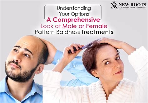 2024 Guide To Male Or Female Pattern Baldness Treatments