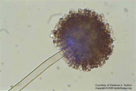 Mycobacterium Mycology Parasites Iii Parasites Legionella Mycoplasma Flashcards Quizlet