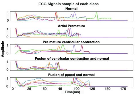 Samples Of Each Class In The Mit Bih Dataset Download Scientific Diagram